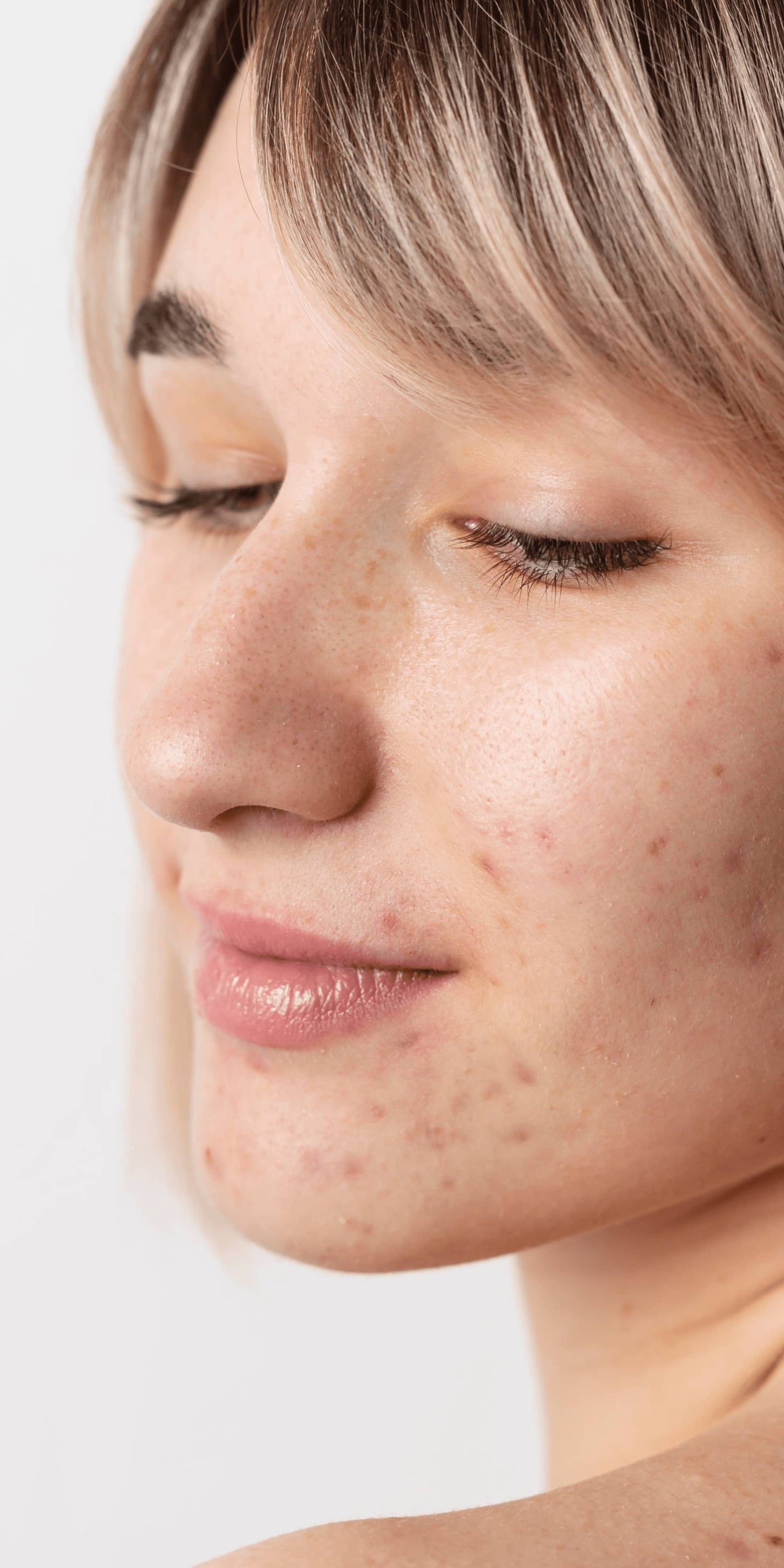 Dark Spot and Pigmentation Skin Routine (Combination Skin) – Natavis